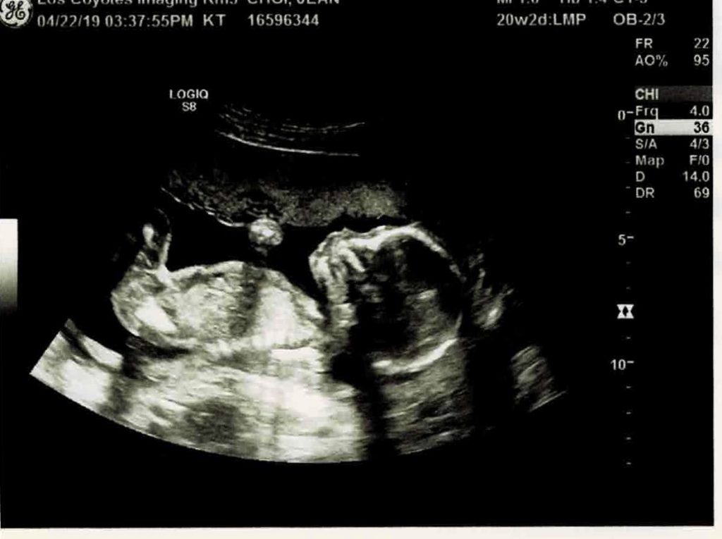 21 Week Bump Update + GENDER REVEAL! – What Great Grandma Ate